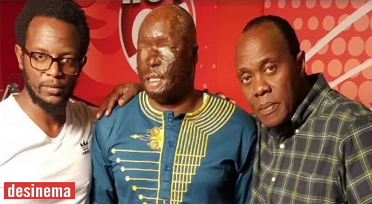 My wife poured acid on my face while I was asleep ex police officer ...